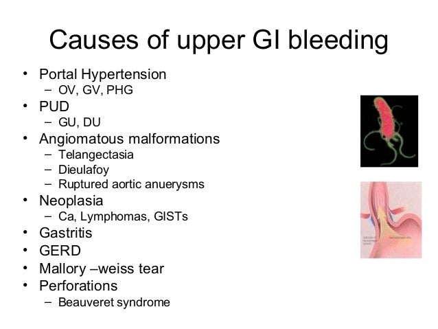 Upper gi bleeding
