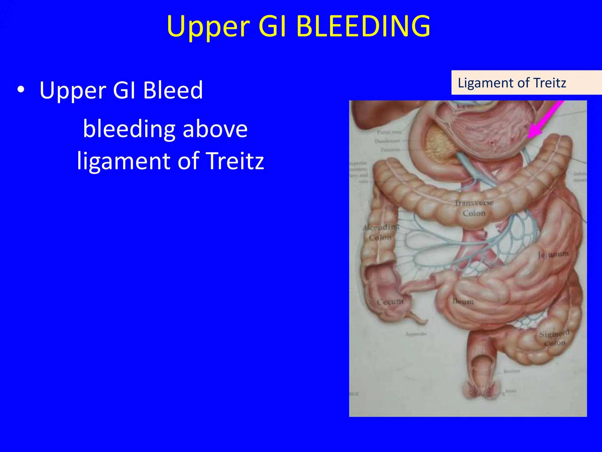 Upper GI bleeding gastroenterology .pptx