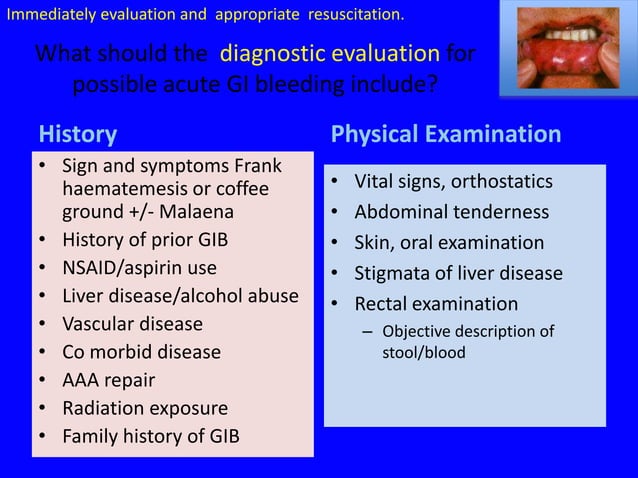 Upper GI bleeding gastroenterology .pptx