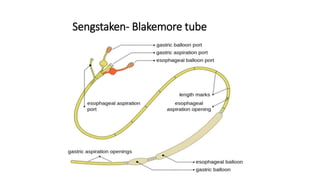 Modified Sengstaken Blakemore Tube