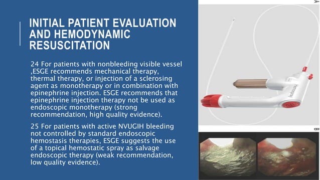 Upper GI Bleeding guidelines ppt.pptx | Blood Disorders | Diseases and ...