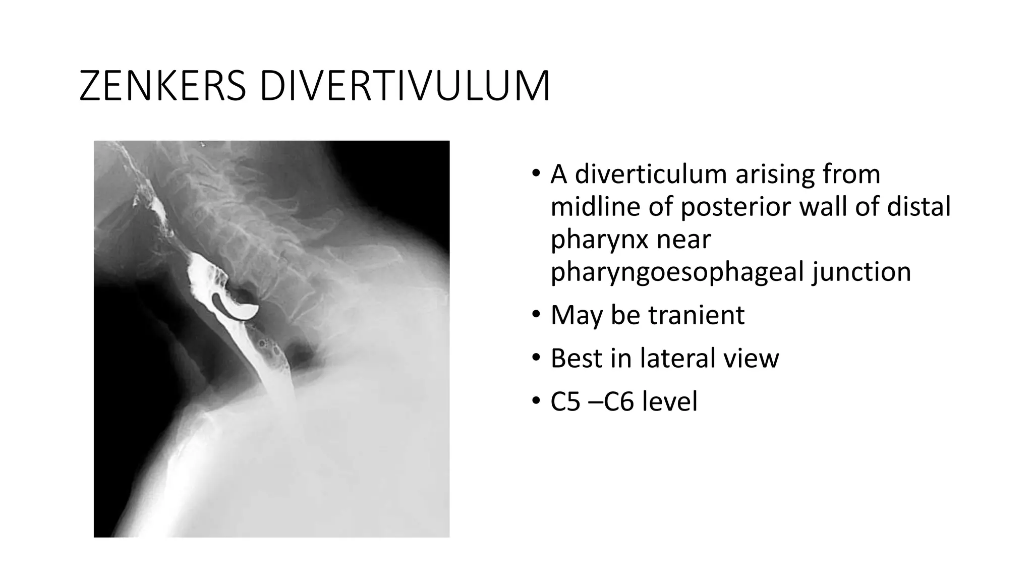UPPER GI FLURO EXAM.pptx