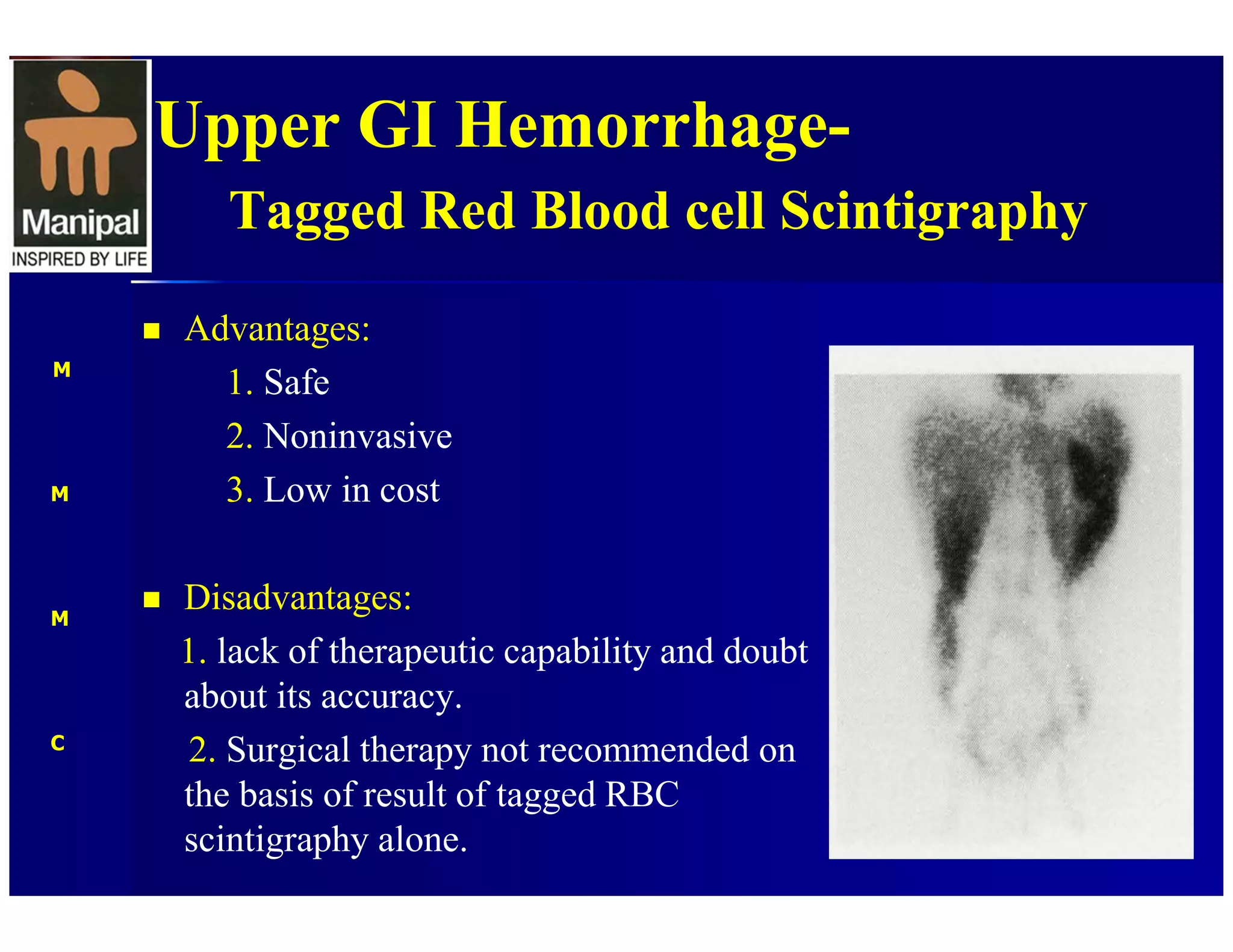 Upper GI Hemorrhage-- Surgical perspective | PDF