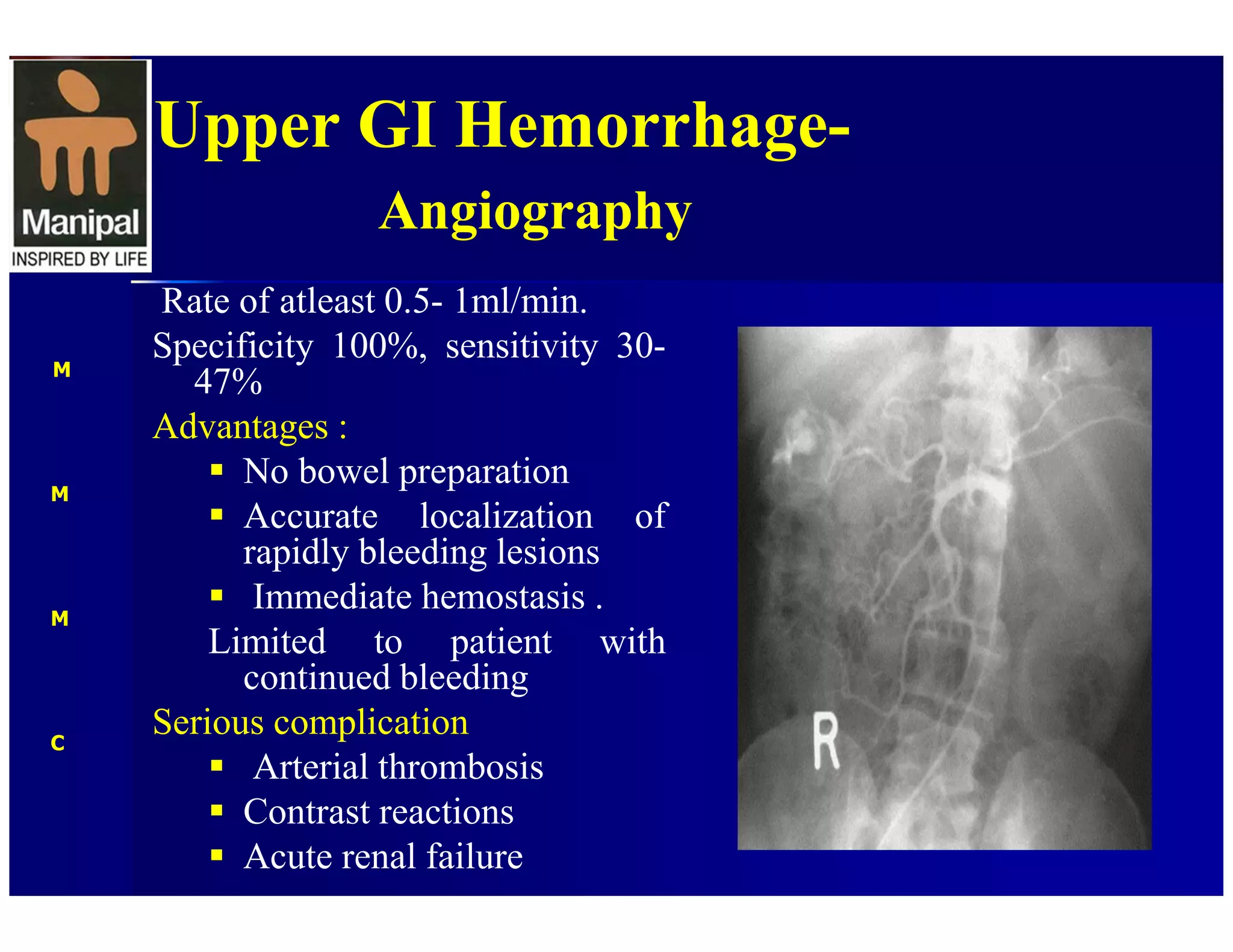 Upper GI Hemorrhage-- Surgical perspective | PDF