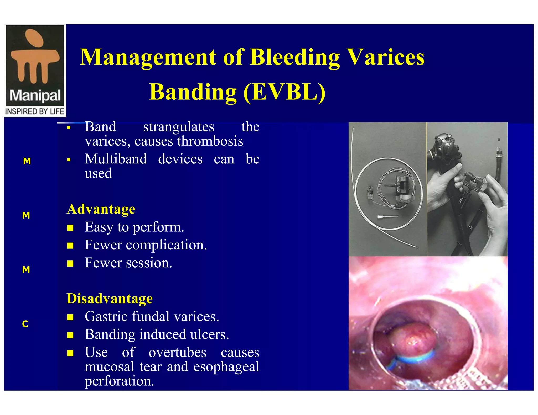 Upper GI Hemorrhage-- Surgical perspective | PDF