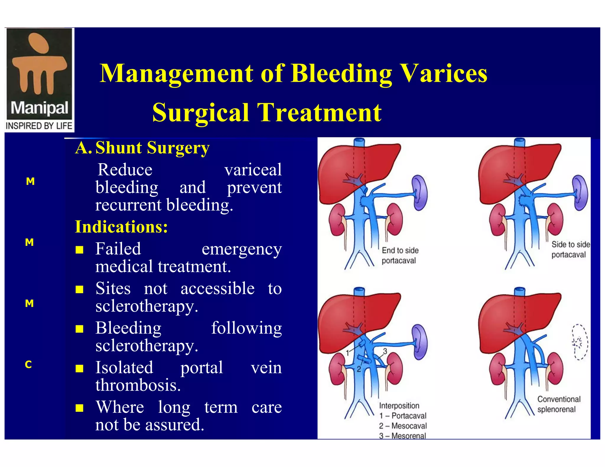 Upper GI Hemorrhage-- Surgical perspective | PDF