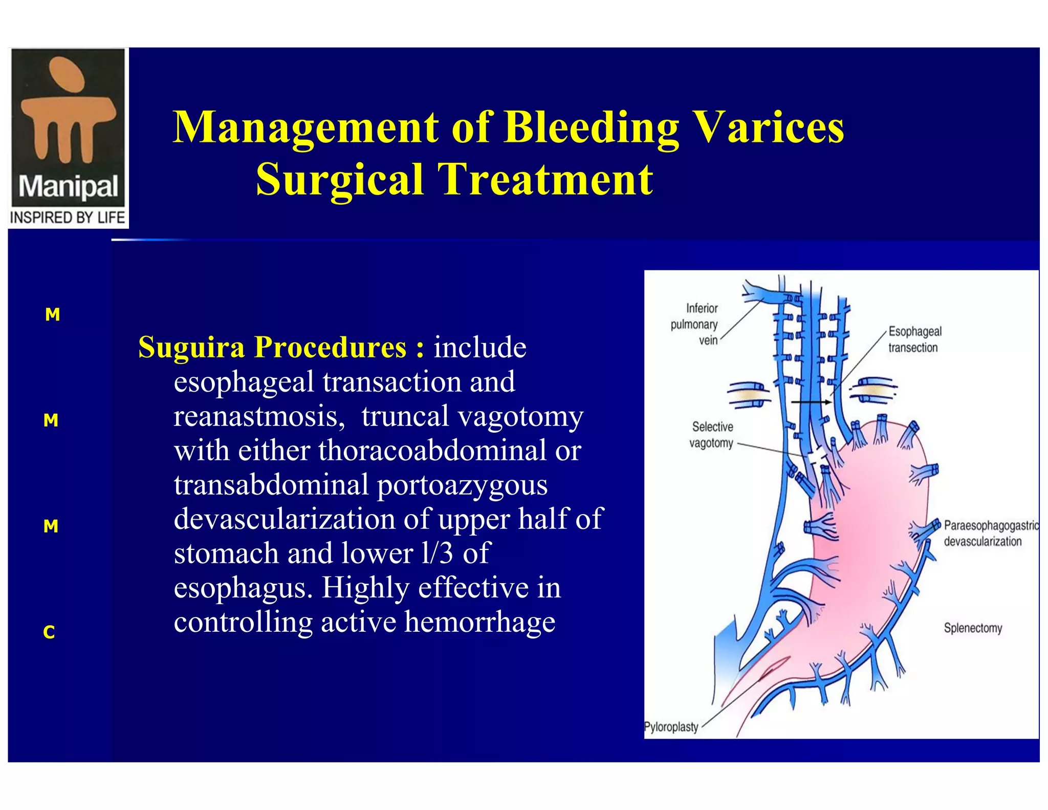 Upper GI Hemorrhage-- Surgical perspective | PDF
