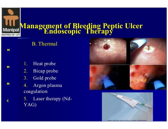 Upper GI Hemorrhage-- Surgical perspective