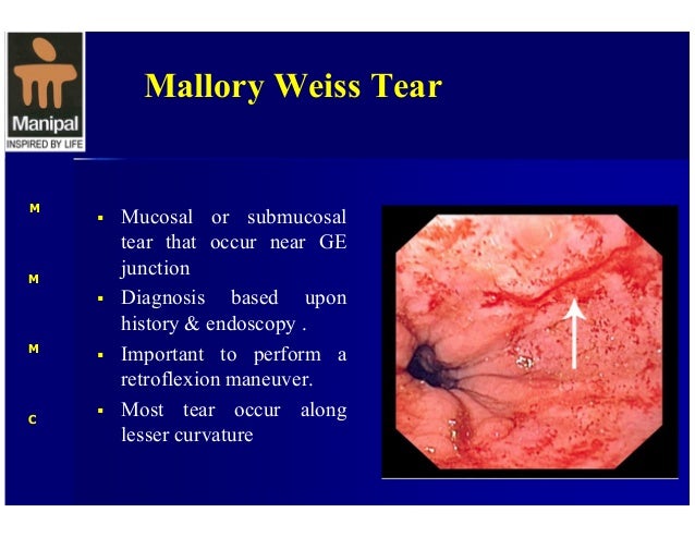 Upper GI Hemorrhage-- Surgical perspective