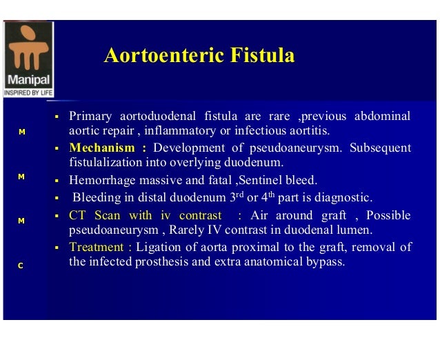 Upper GI Hemorrhage-- Surgical perspective