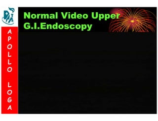 Upper GI Endoscopy - A pictorial overview | PDF
