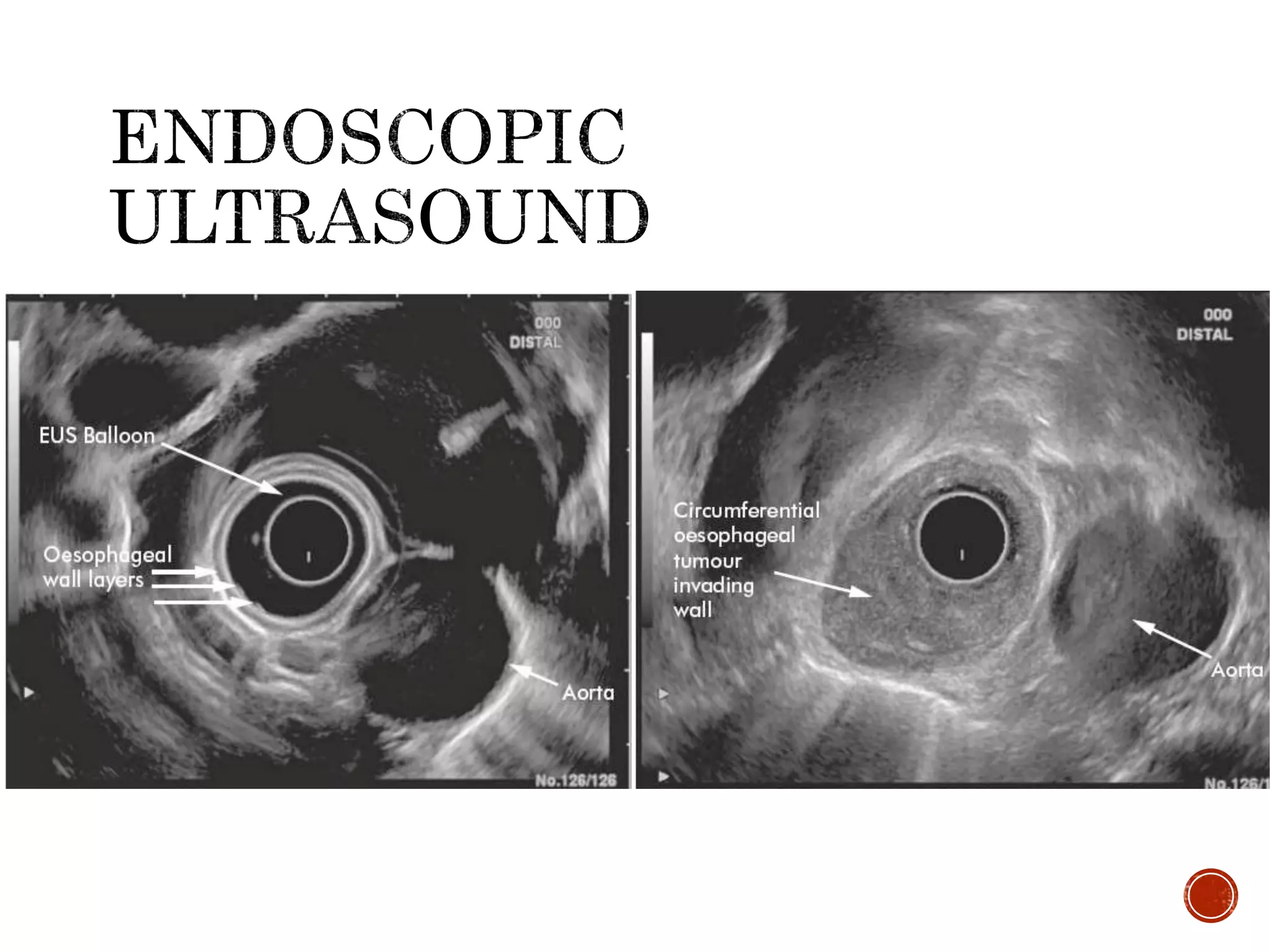 Gastrointestinal endoscopy | PPTX | Digestive Disorders | Diseases and ...