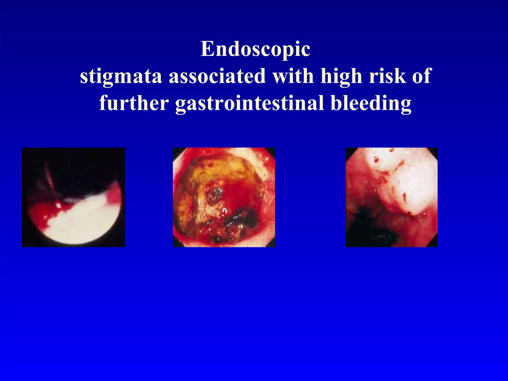 Upper git bleeding | PPT