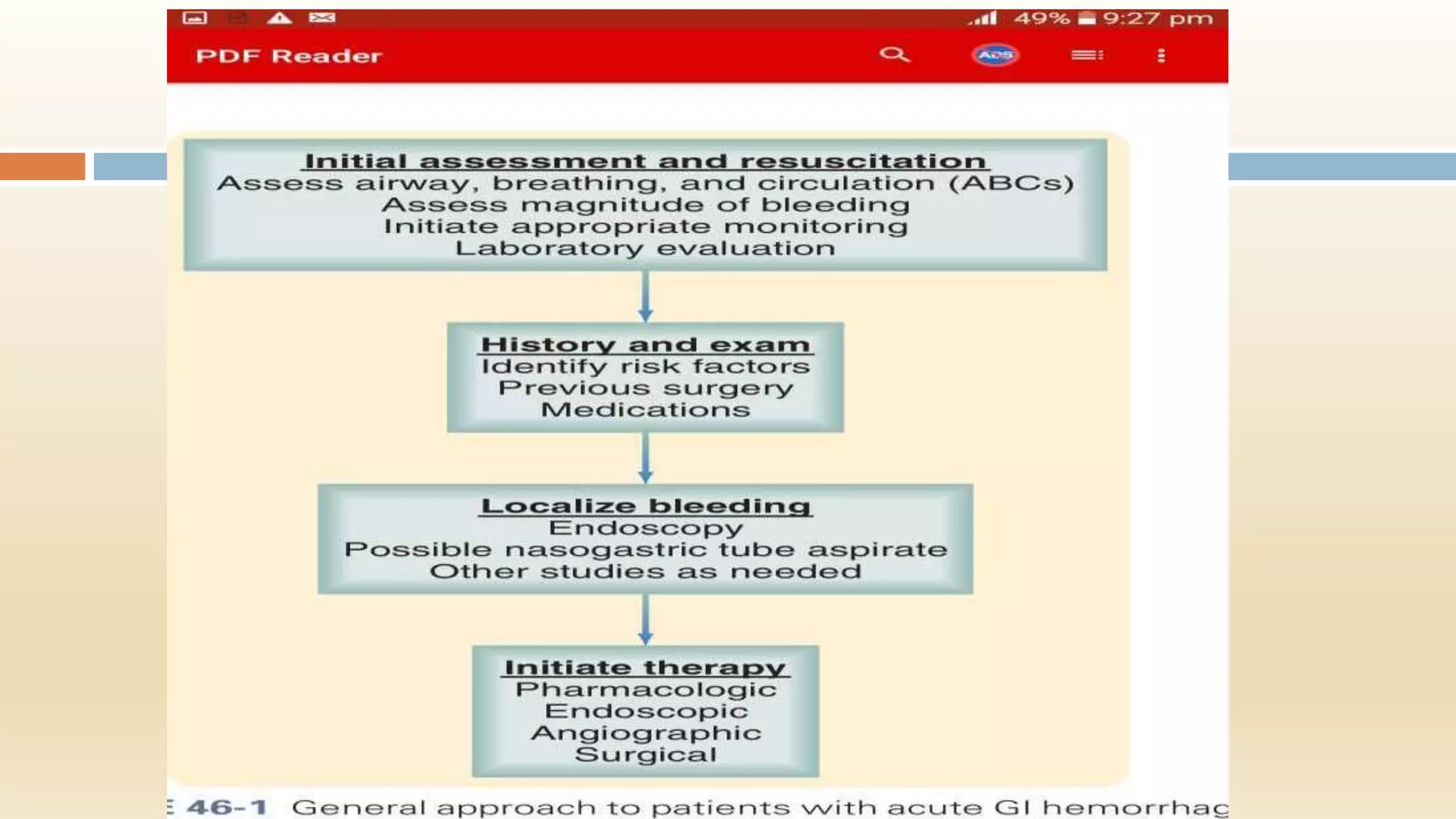 UPPER GIT BLEEDING.pptx