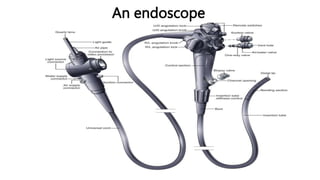 upper GIT symptoms and role of endoscopy.pptx