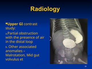 UPPER GASTROINTESTINAL ANOMALIES IN NEWBORN | PPT
