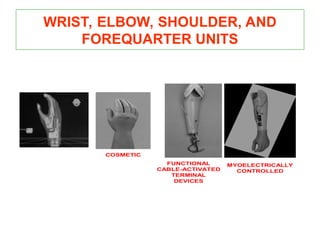 UPPER limb prosthesis for biomechanics study | PPT