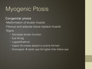Upper Lid Ptosis | PPT