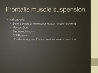 Upper Lid Ptosis | PPT