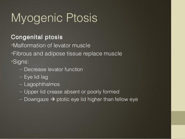 Upper Lid Ptosis