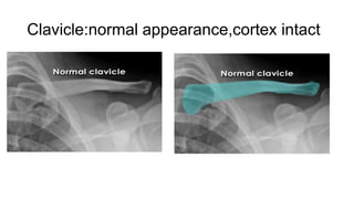 Upper Limb | PPTX