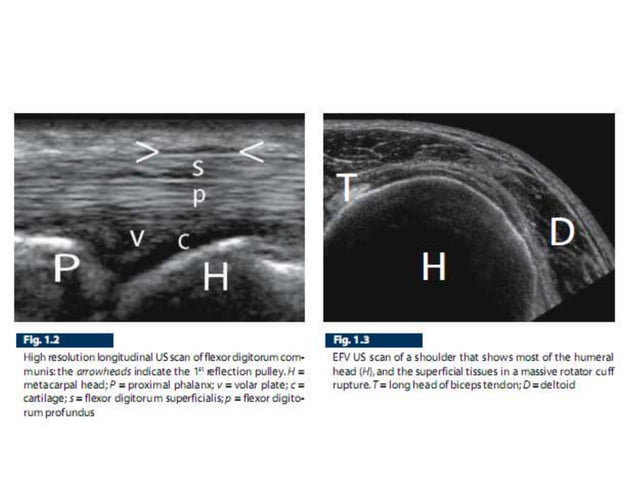 UPPER LIMB ULTRASOUND ANATOMY for Medical Students | PPT