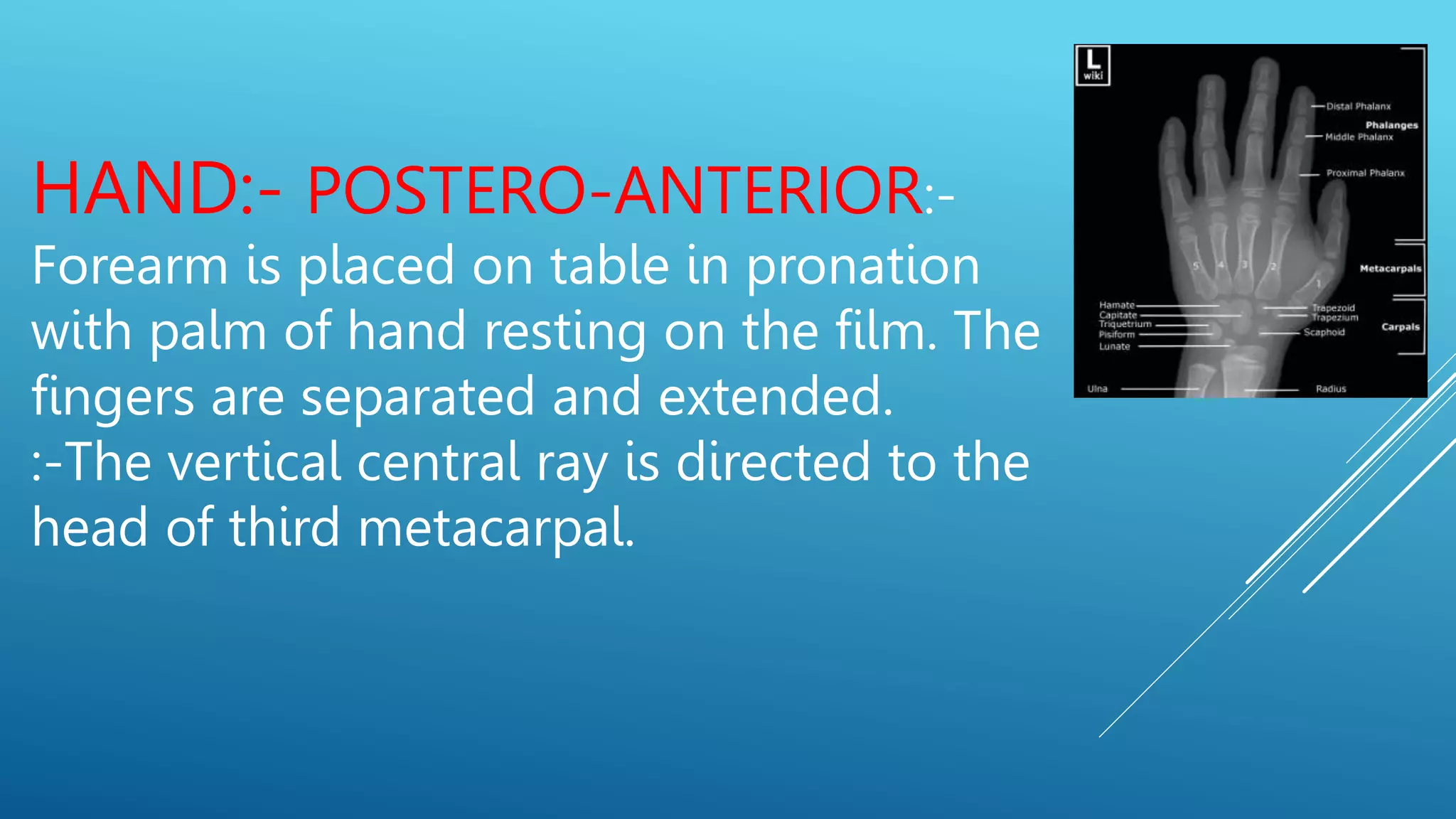 upper limb | PPTX