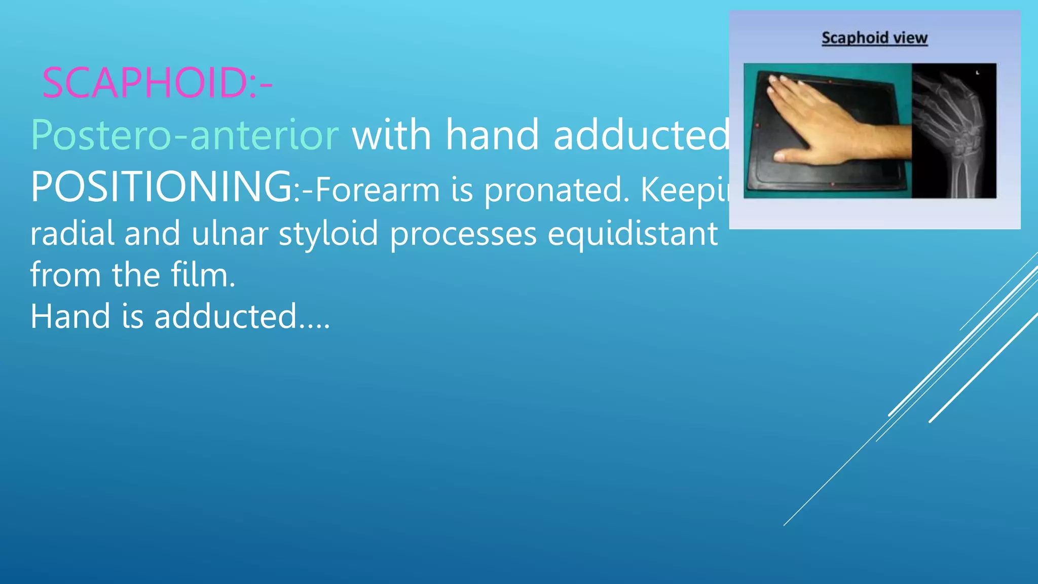upper limb | PPTX