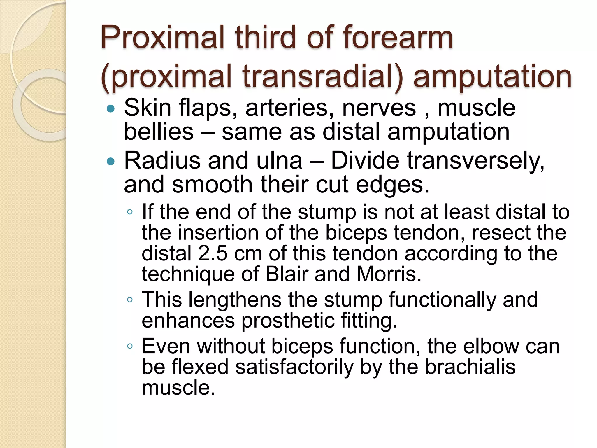 Upper Limb Amputations | PPTX