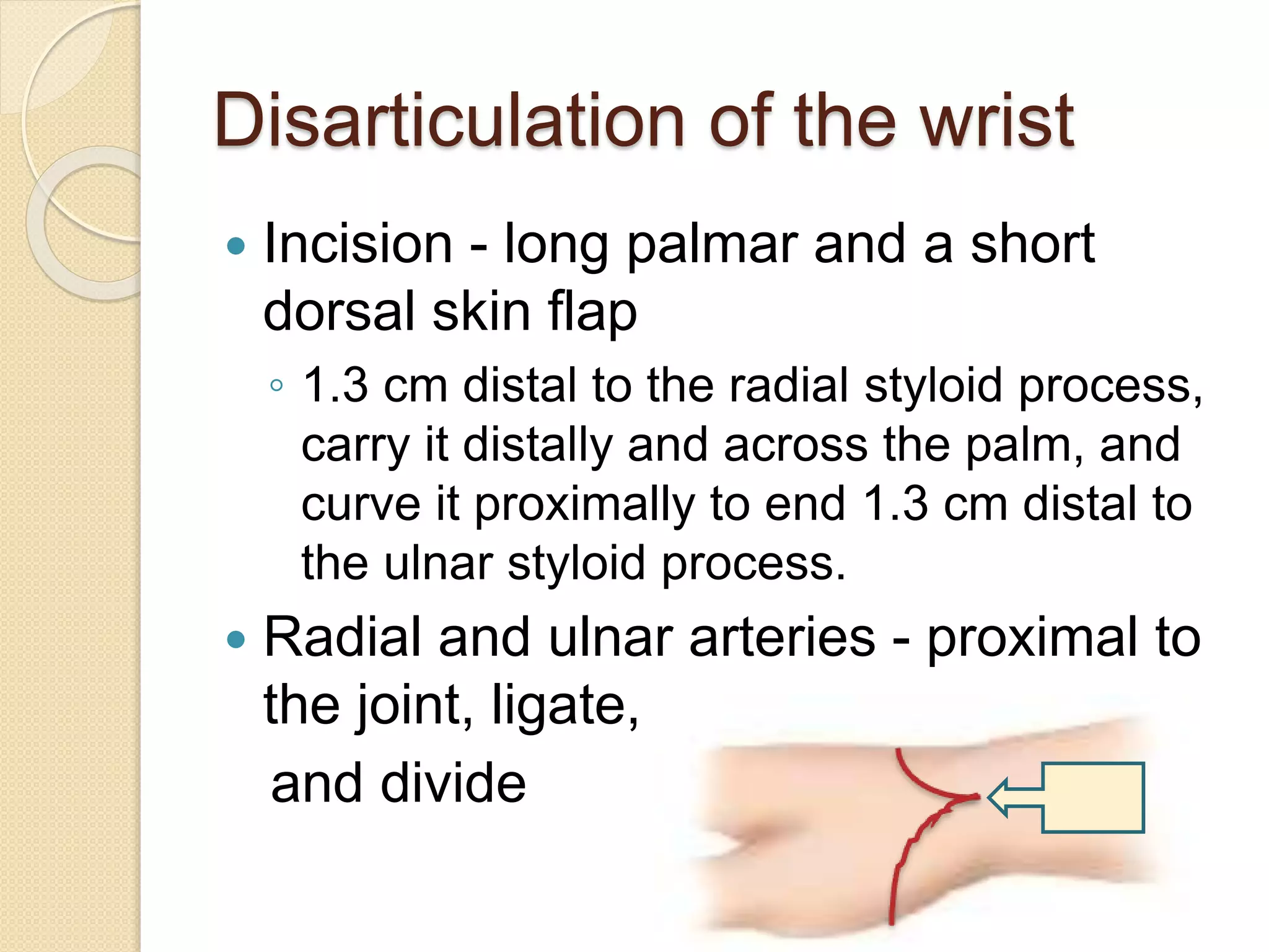 Upper Limb Amputations | PPTX