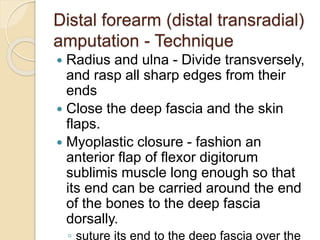 Upper Limb Amputations | PPTX