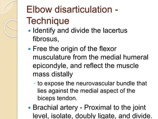 Upper Limb Amputations | PPTX