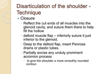Upper Limb Amputations | PPTX