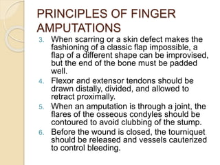 Upper Limb Amputations | PPTX