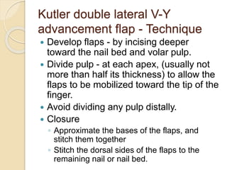 Upper Limb Amputations | PPTX