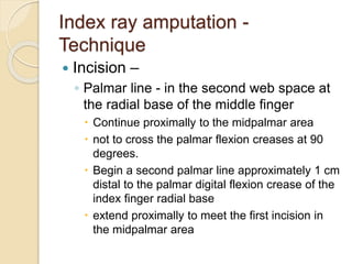 Upper Limb Amputations | PPTX