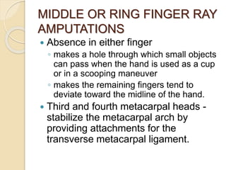 Upper Limb Amputations | PPTX