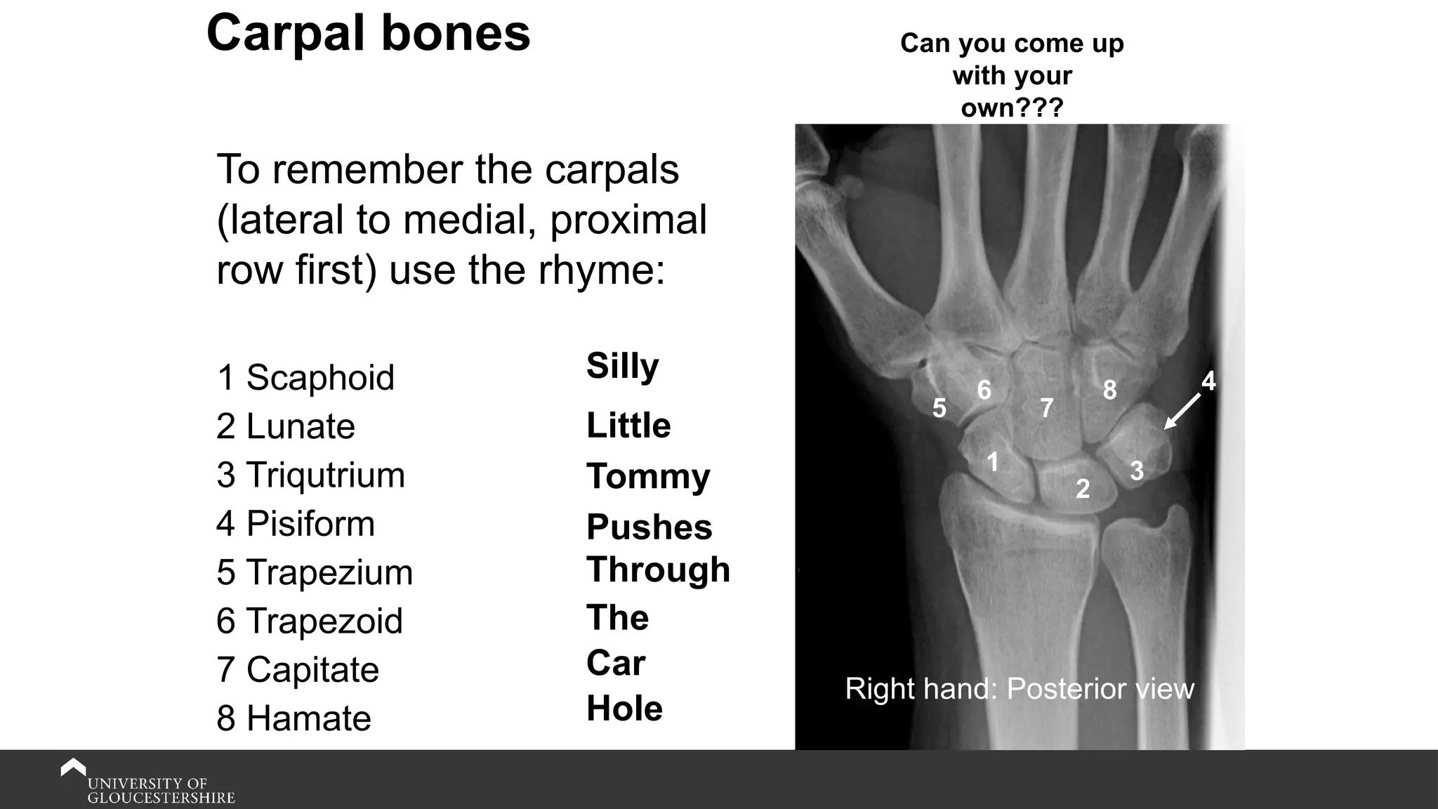 Upper Limb Anatomy Slides forearm , arm, | PPTX
