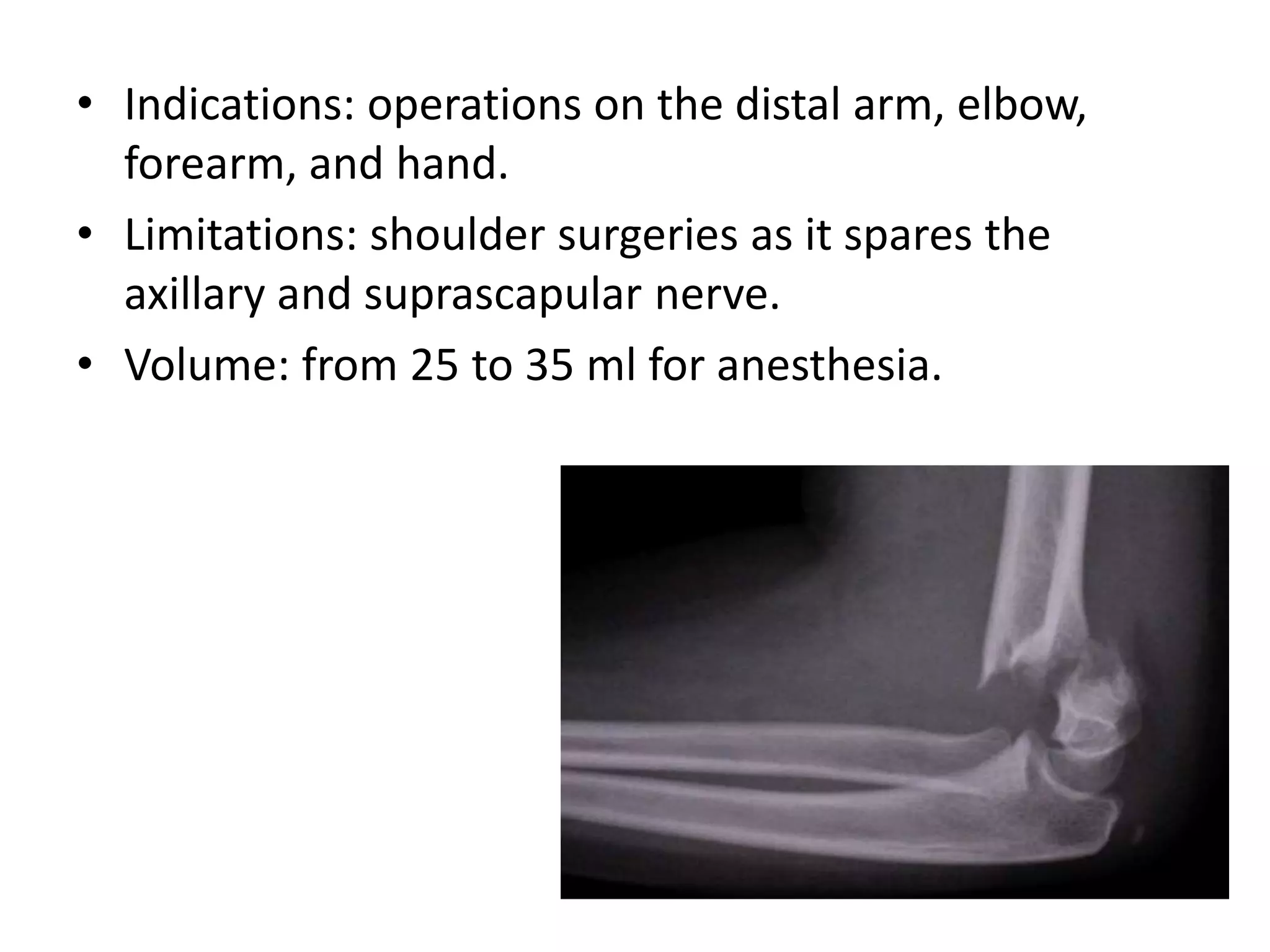 Upper limb blocks | PPT