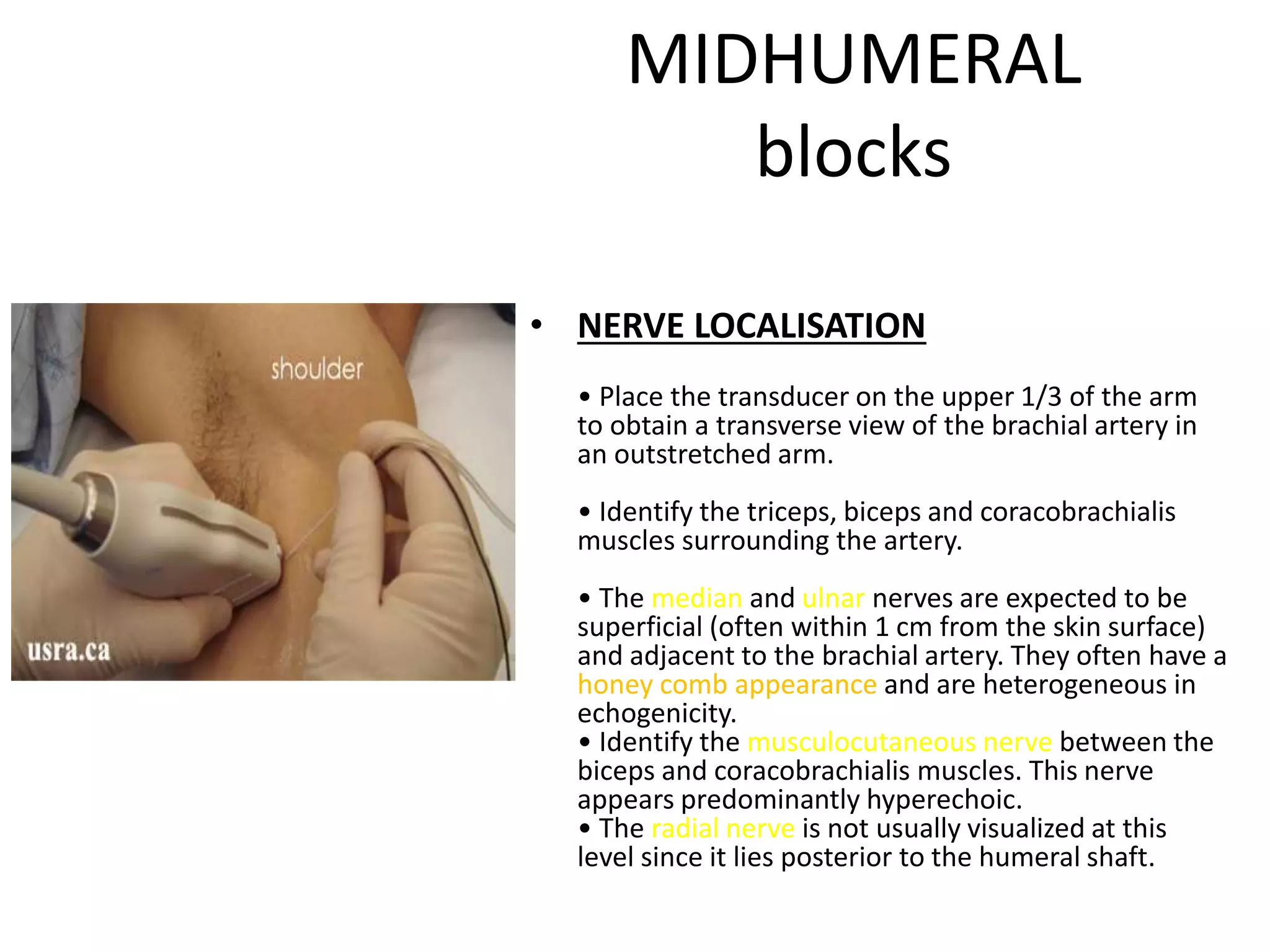 Upper limb blocks | PPT