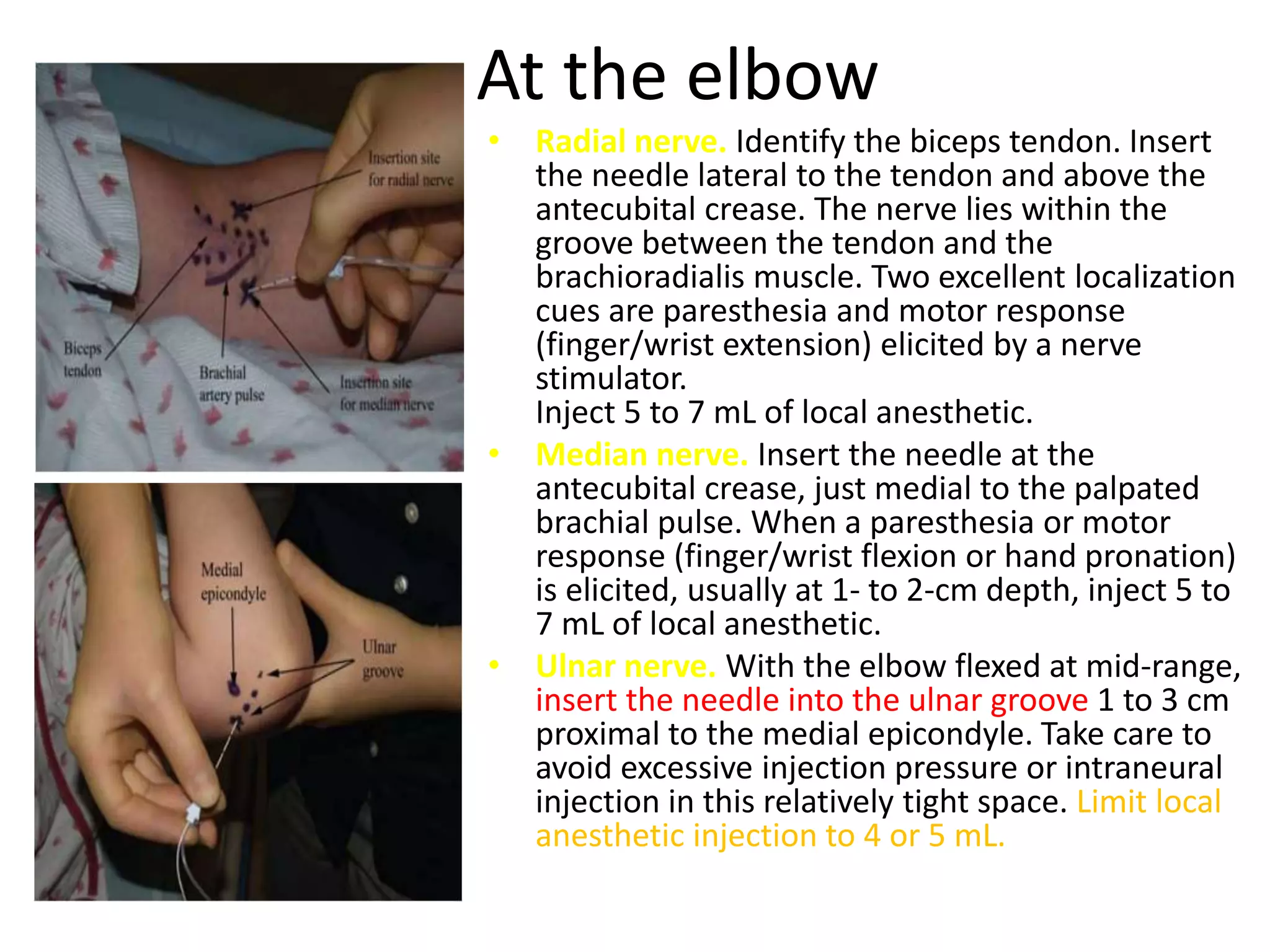 Upper limb blocks | PPT