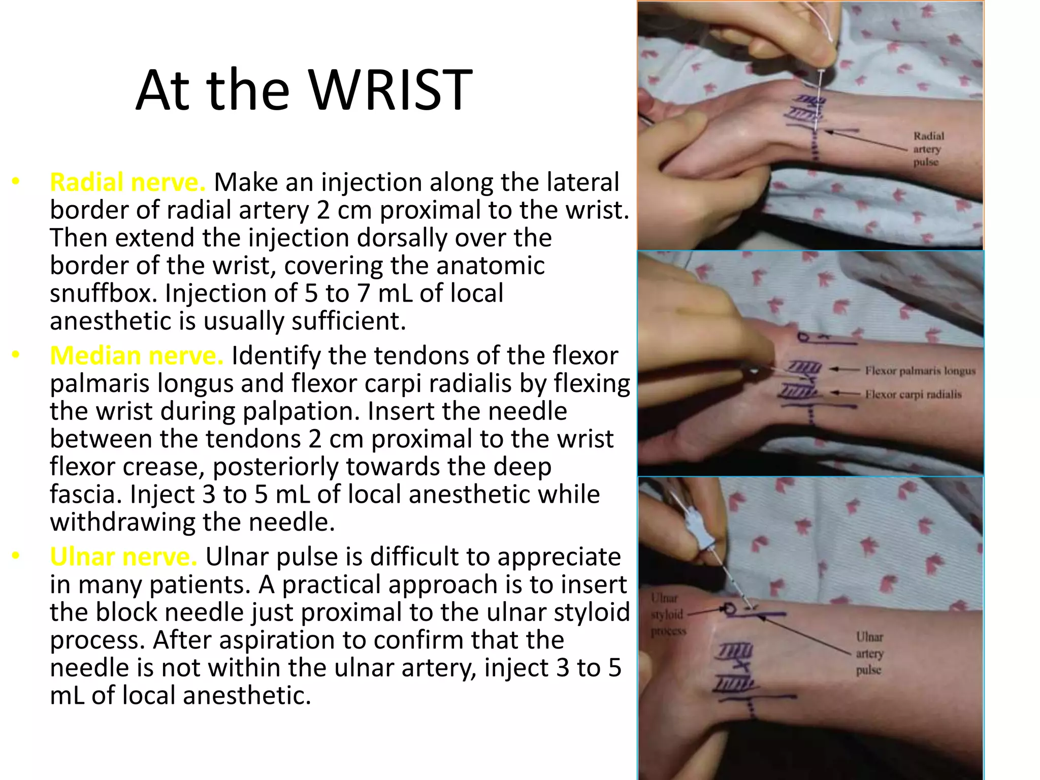 Upper limb blocks | PPT