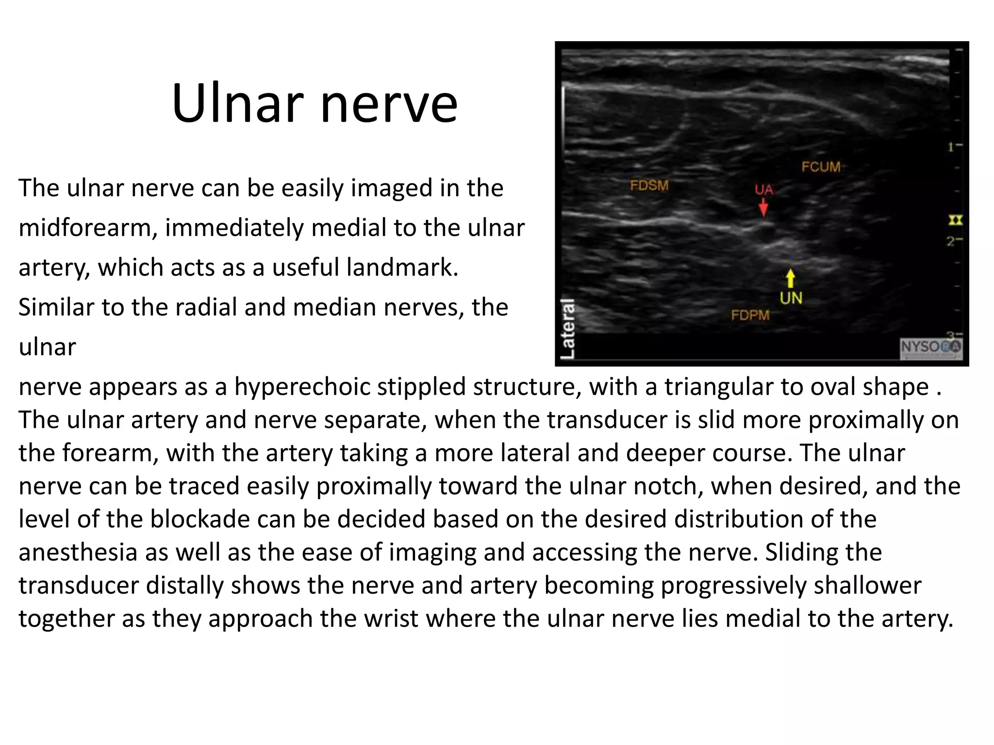 Upper limb blocks | PPT