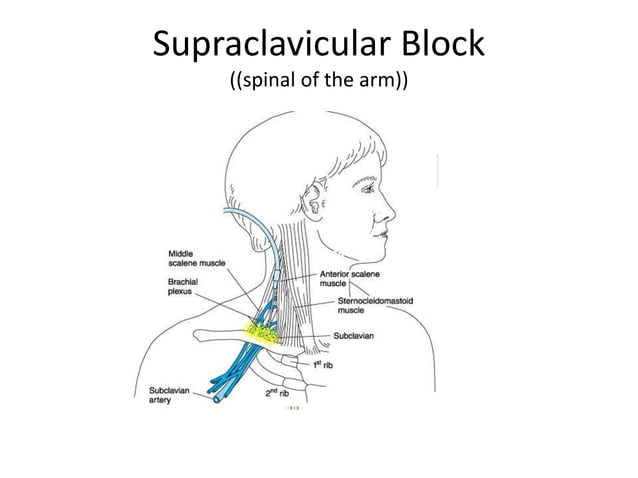 Upper limb blocks | PPT | First Aid | Injuries