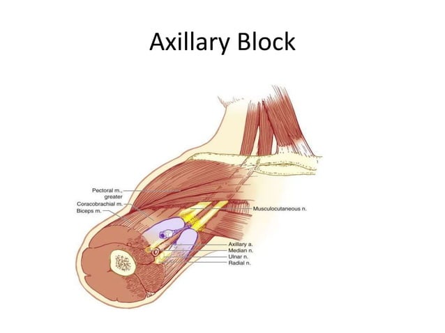 Upper limb blocks | PPT | First Aid | Injuries
