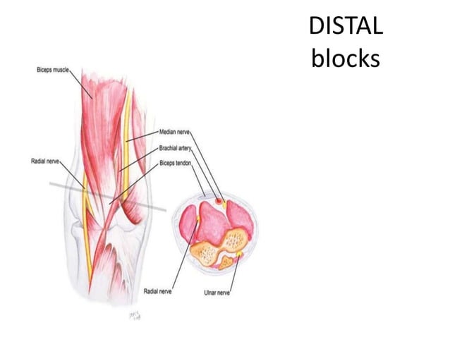 Upper limb blocks | PPT | First Aid | Injuries