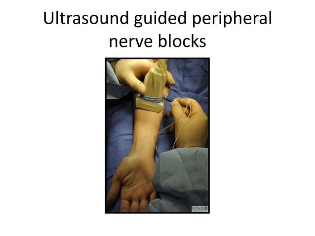 Upper limb blocks | PPT | First Aid | Injuries