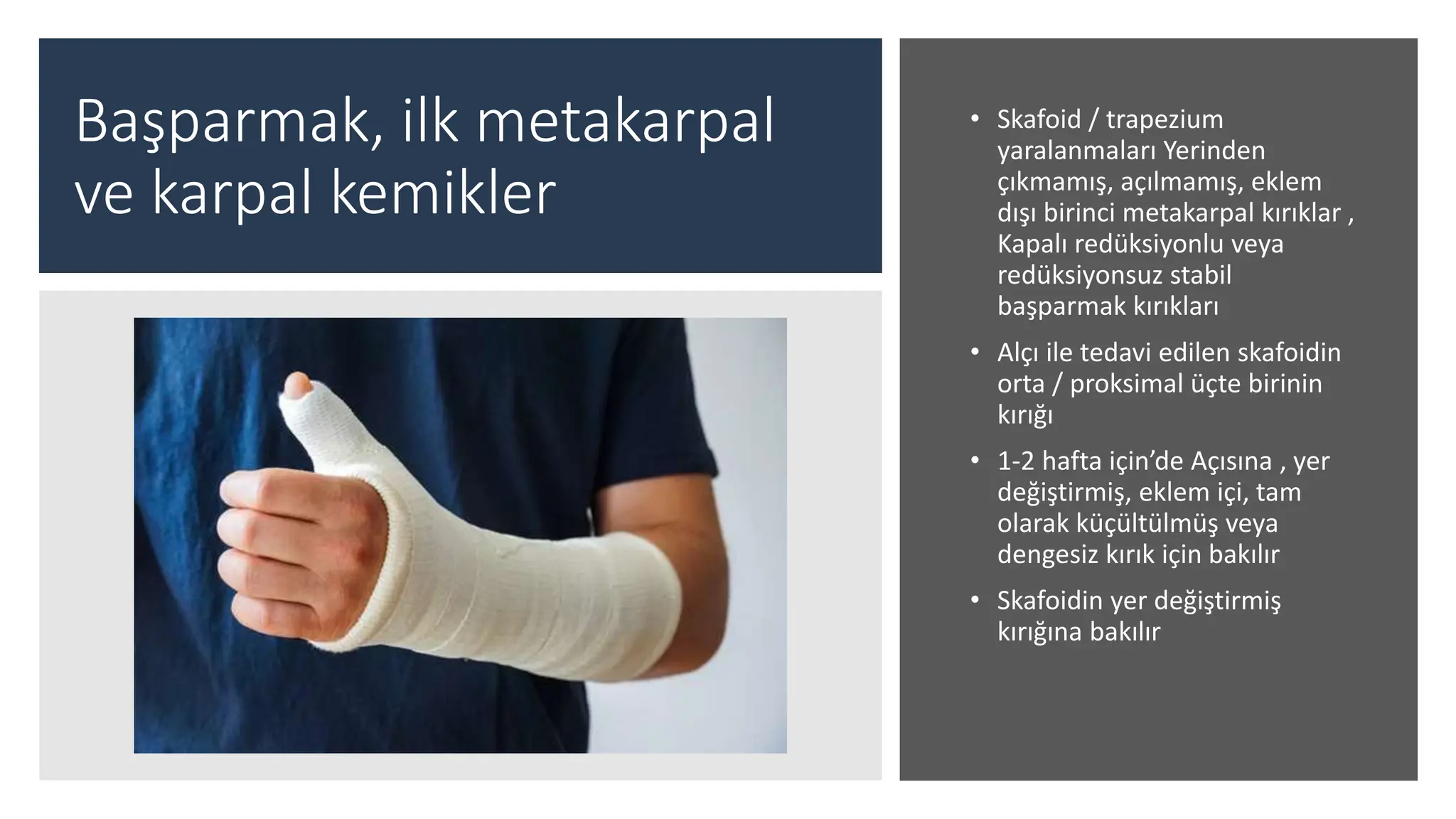 upper limb casting | PPT