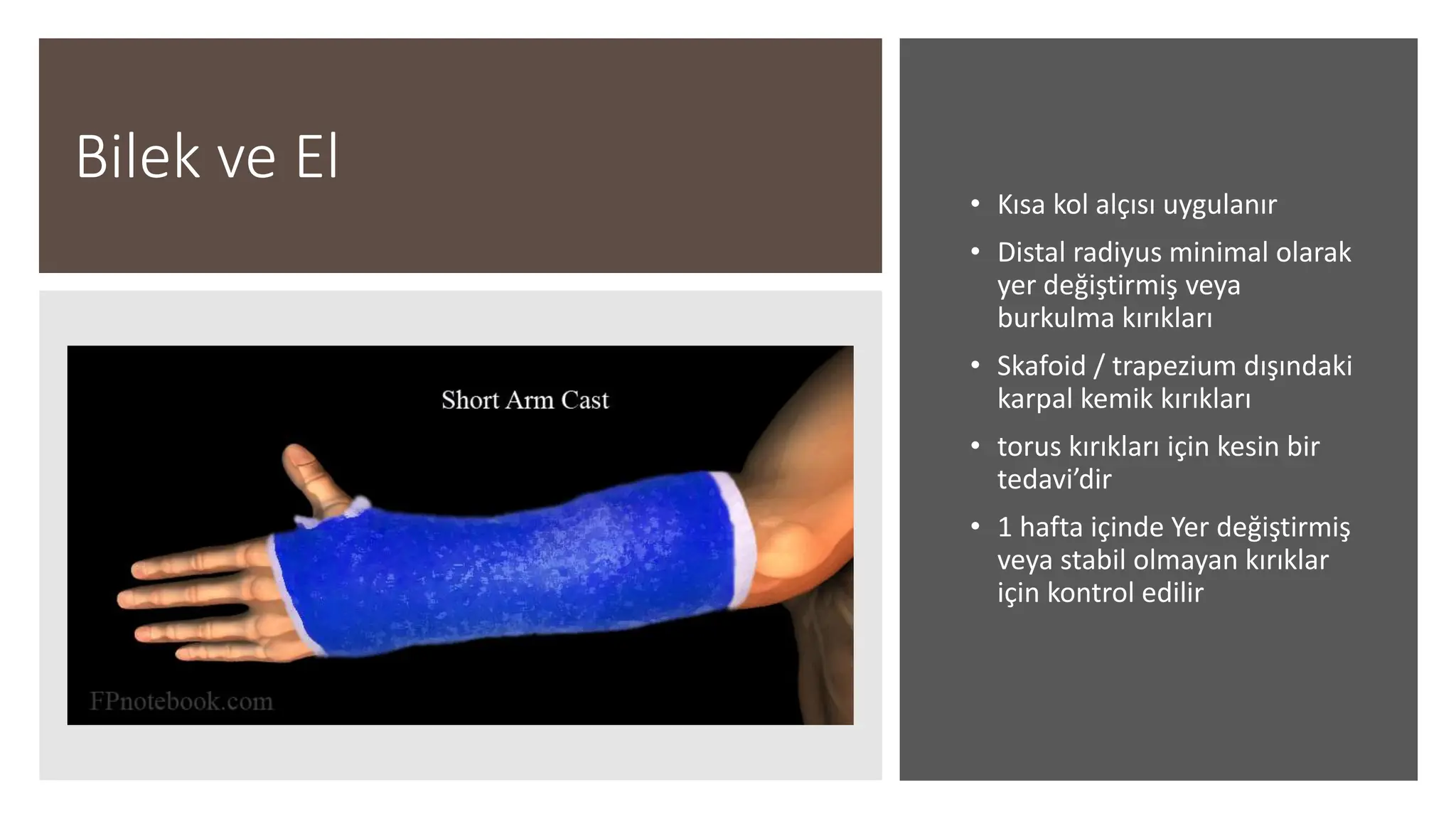upper limb casting | PPT