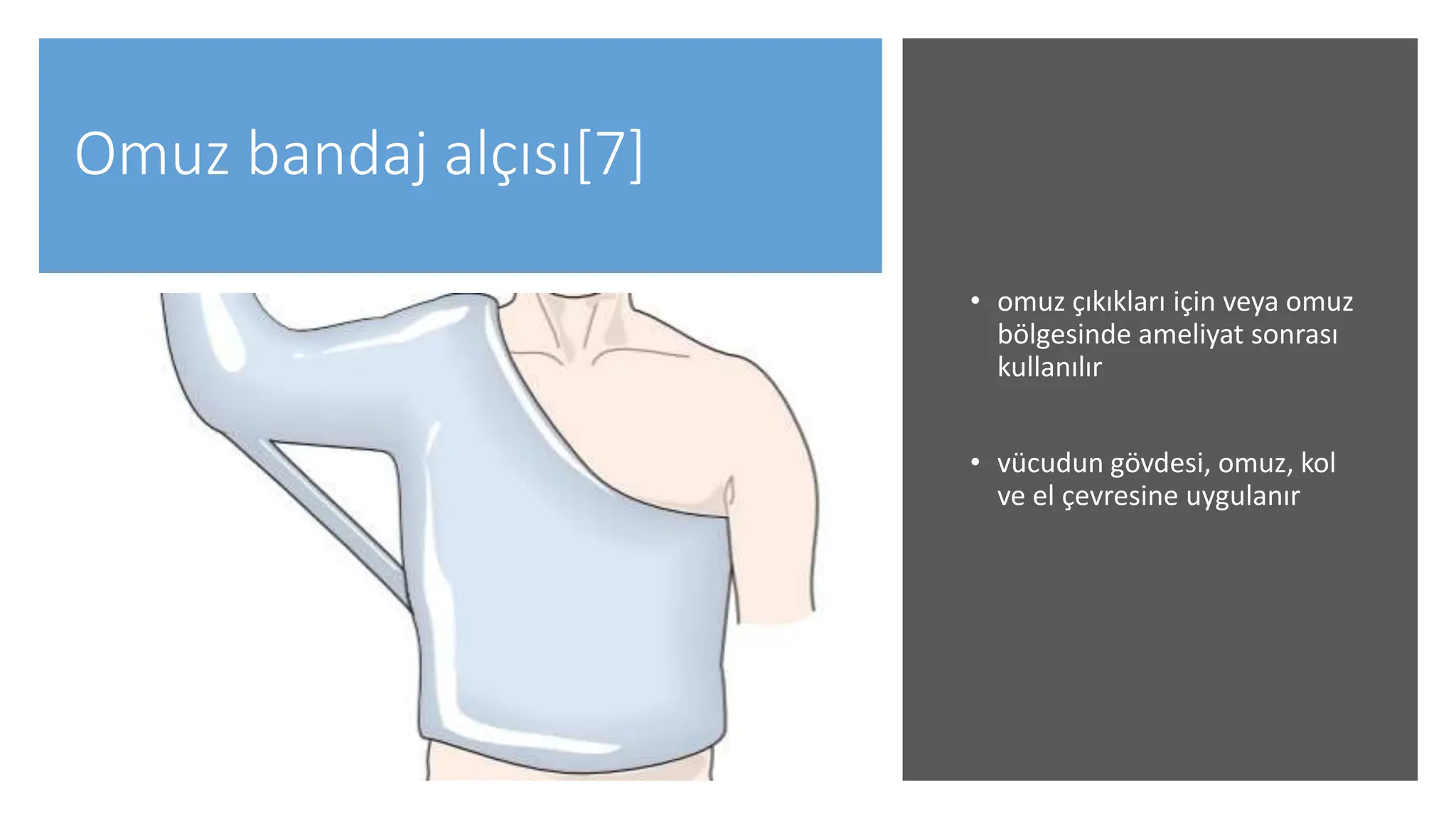 upper limb casting | PPT